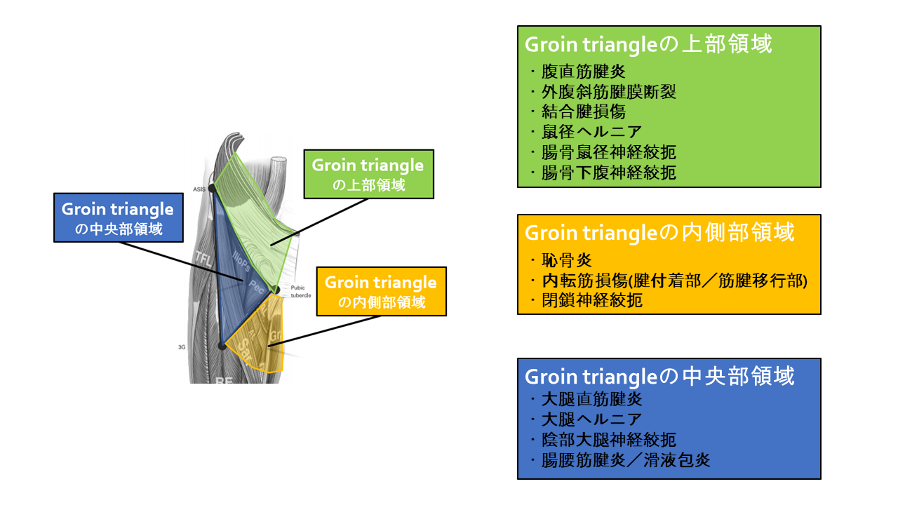 グローインぺイン症候群（鼠径部痛）の病態とリスクファクター - forPT ONLINE