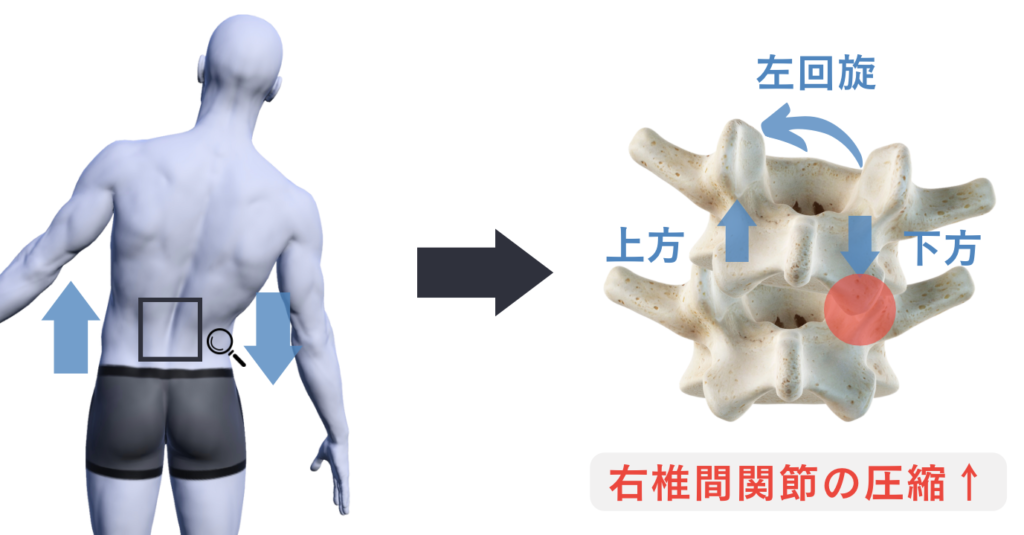 椎間関節性腰痛の理解と評価アプローチ Forpt Online