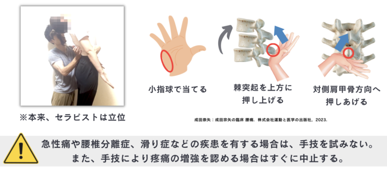 椎間関節性腰痛の理解と評価アプローチ - forPT ONLINE